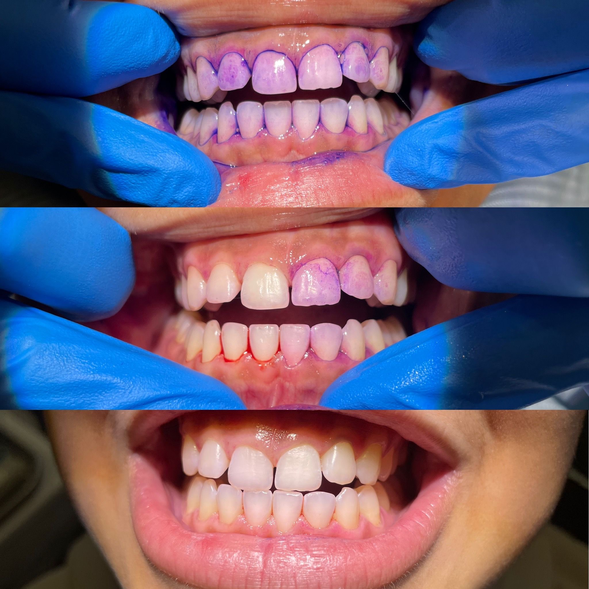 Hygiene Appointments